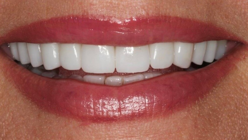 Let your smile shine